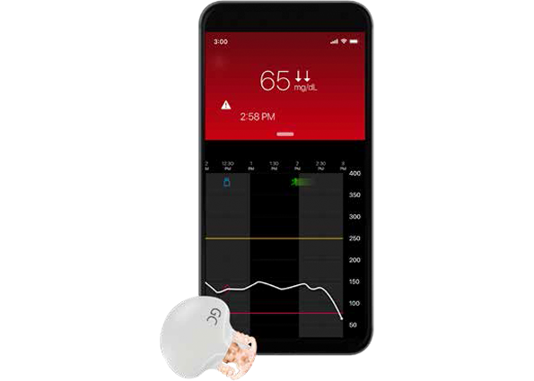 Guardian Smart Transmitter start Kit – My Diabetes Care